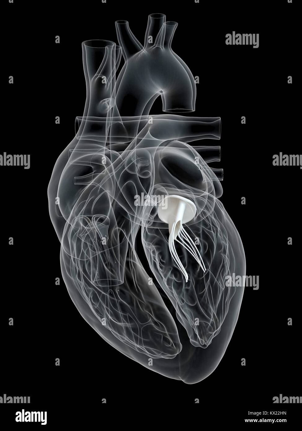Valvola mitrale immagini e fotografie stock ad alta risoluzione - Alamy