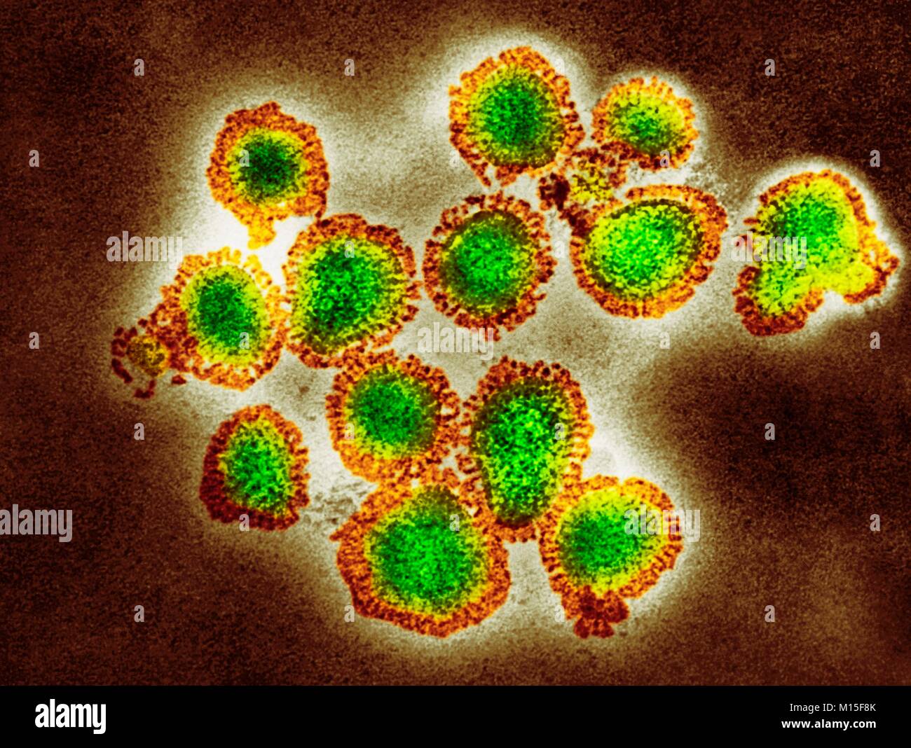 H3N2 virus influenzali di particelle colorate, microscopio elettronico ...