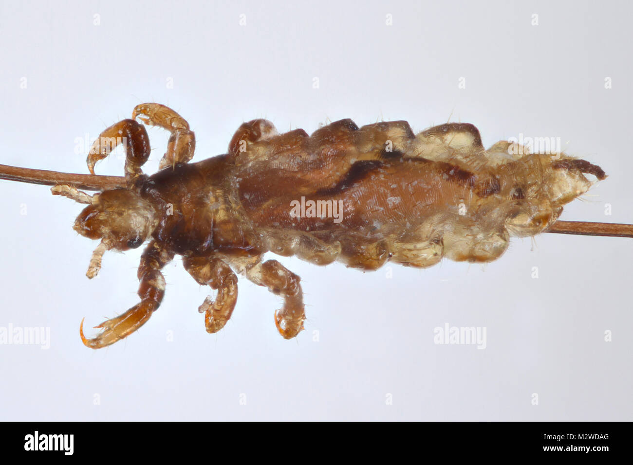 Il pidocchio del corpo Pediculus humanus sui capelli Foto stock - Alamy