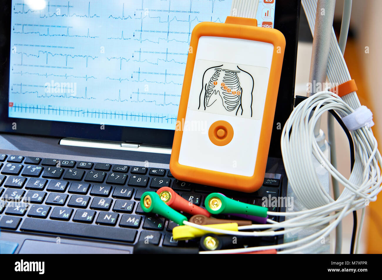 Elettrocardiogramma portatile ecg immagini e fotografie stock ad alta ...