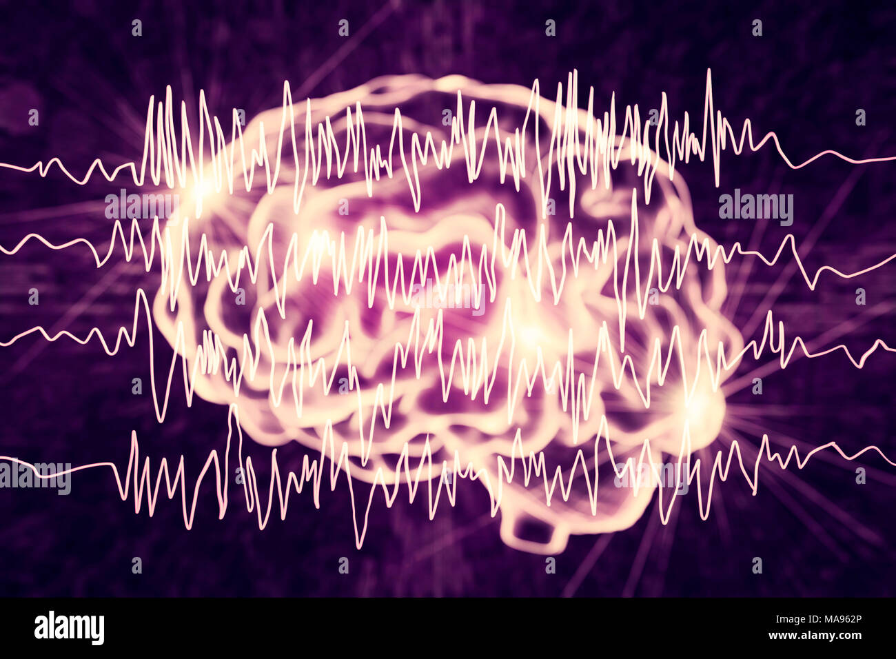 Il cervello e le onde cerebrali di epilessia, illustrazione del ...