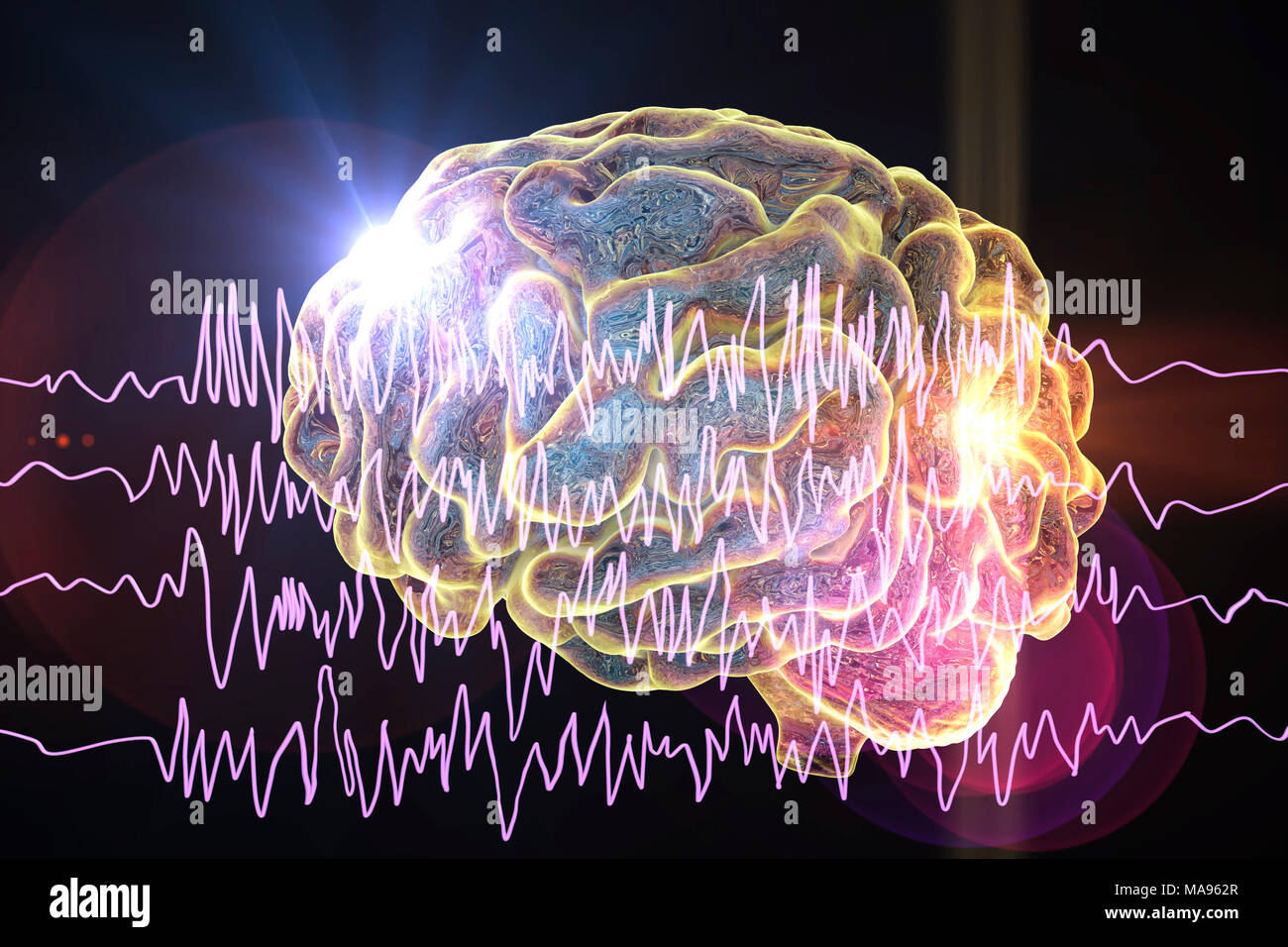 Il cervello e le onde cerebrali di epilessia, illustrazione del ...