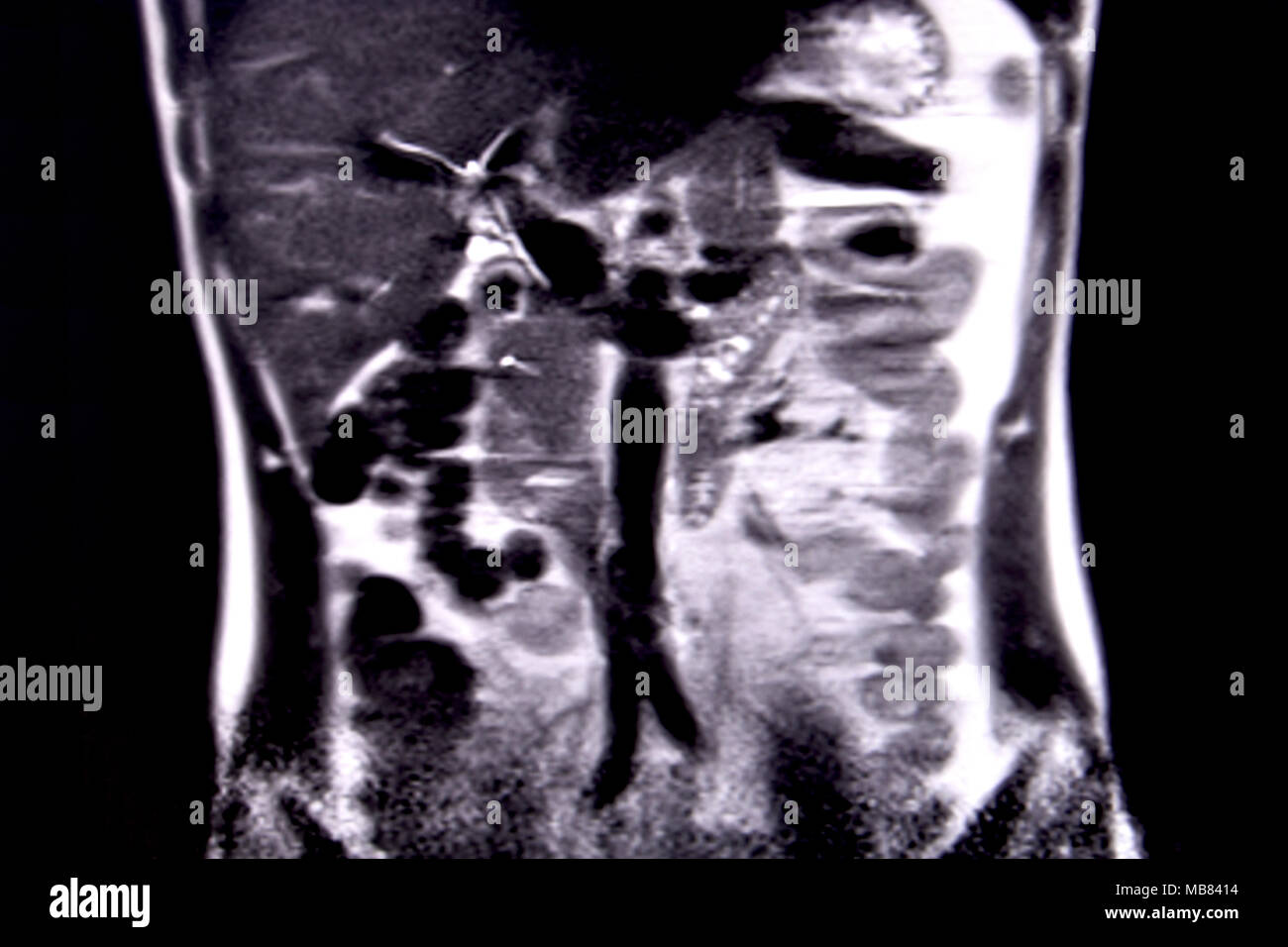 Anatomia torace immagini e fotografie stock ad alta risoluzione - Alamy