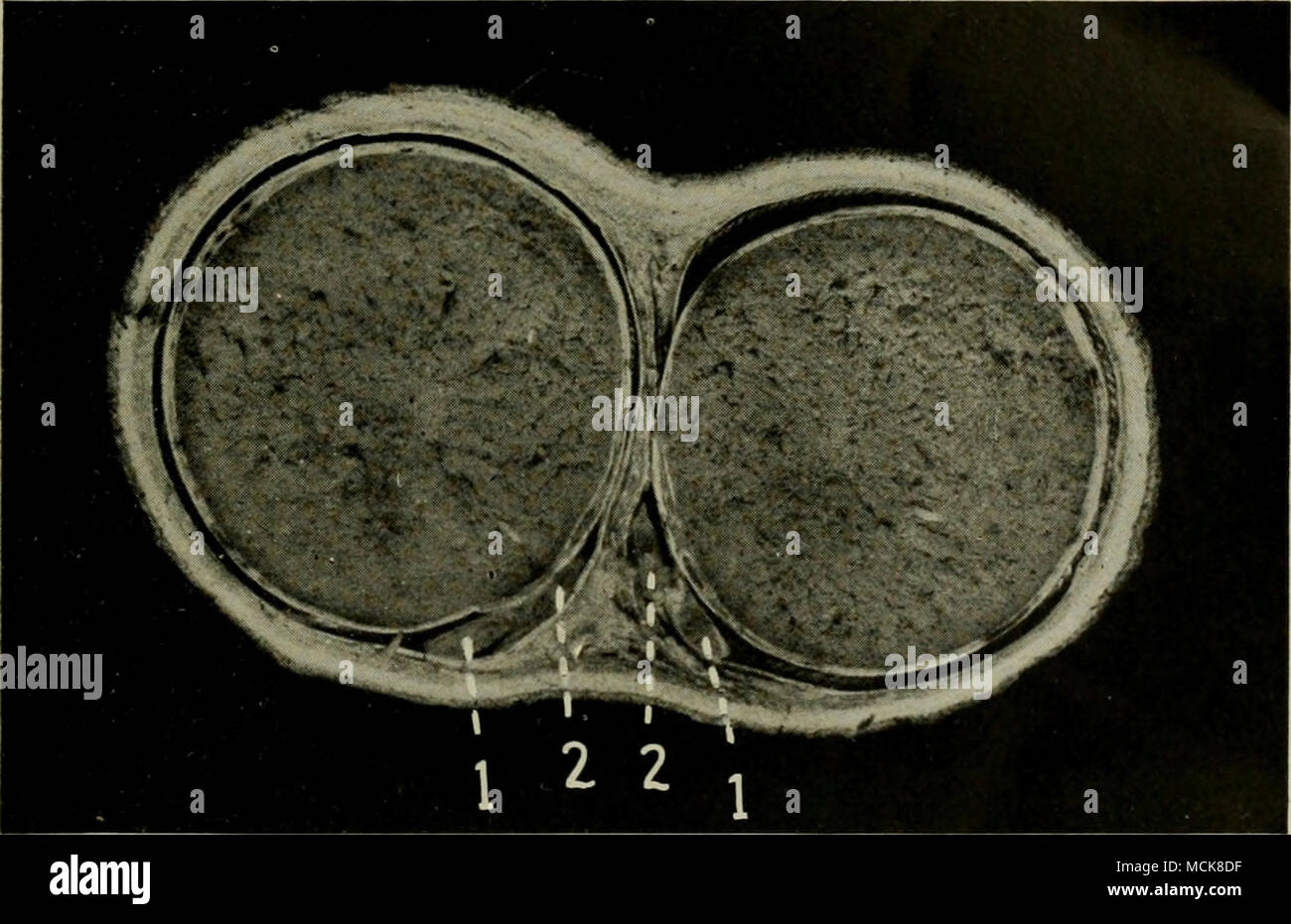 Epididimo sezione trasversale immagini e fotografie stock ad alta ...
