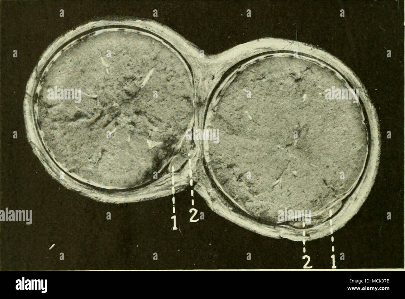 . Fig. 4 sezione trasversale attraverso lo scroto del torello visto dal ...