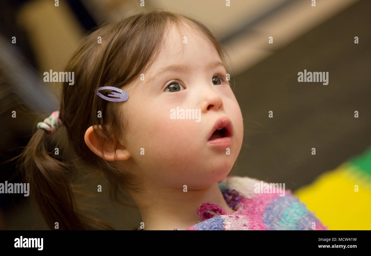 Sindrome di down bambino immagini e fotografie stock ad alta ...