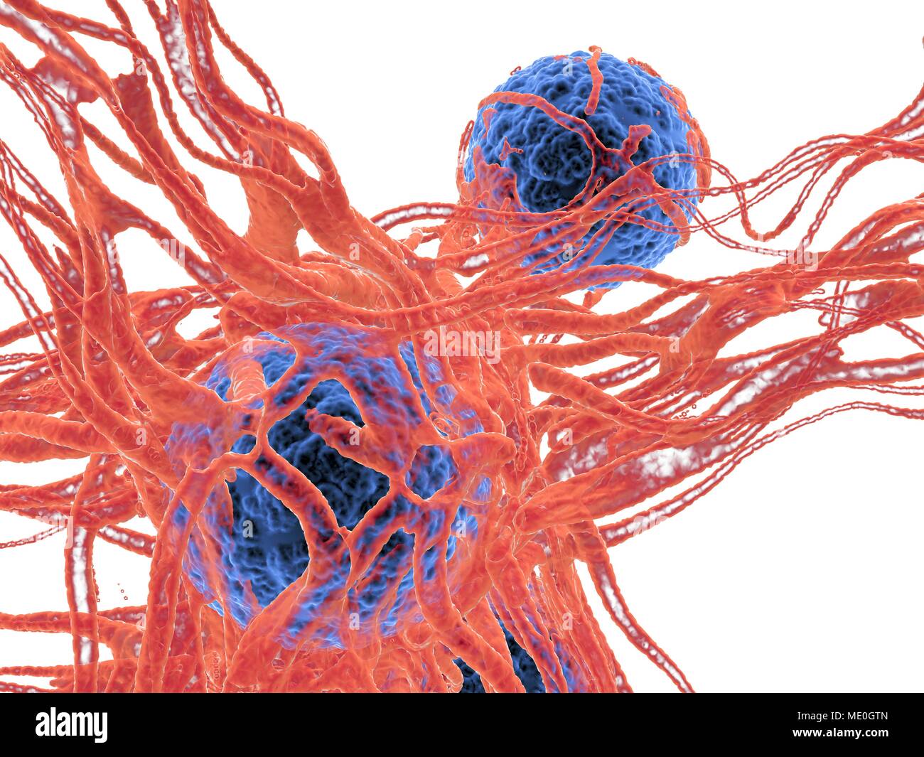 La cellula di cancro. Computer illustrazione delle cellule del cancro ...