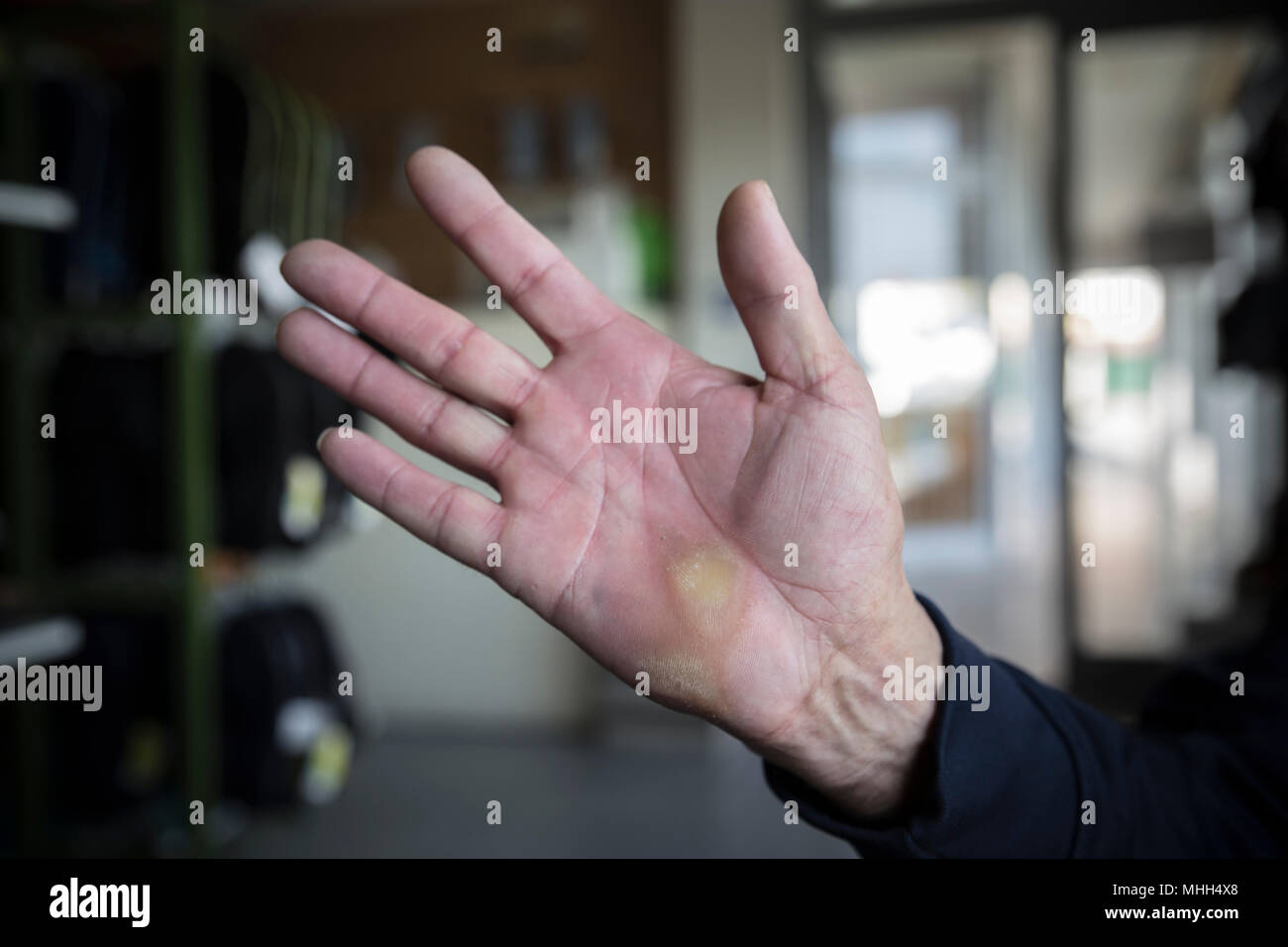 Gestione del trauma immagini e fotografie stock ad alta risoluzione - Alamy