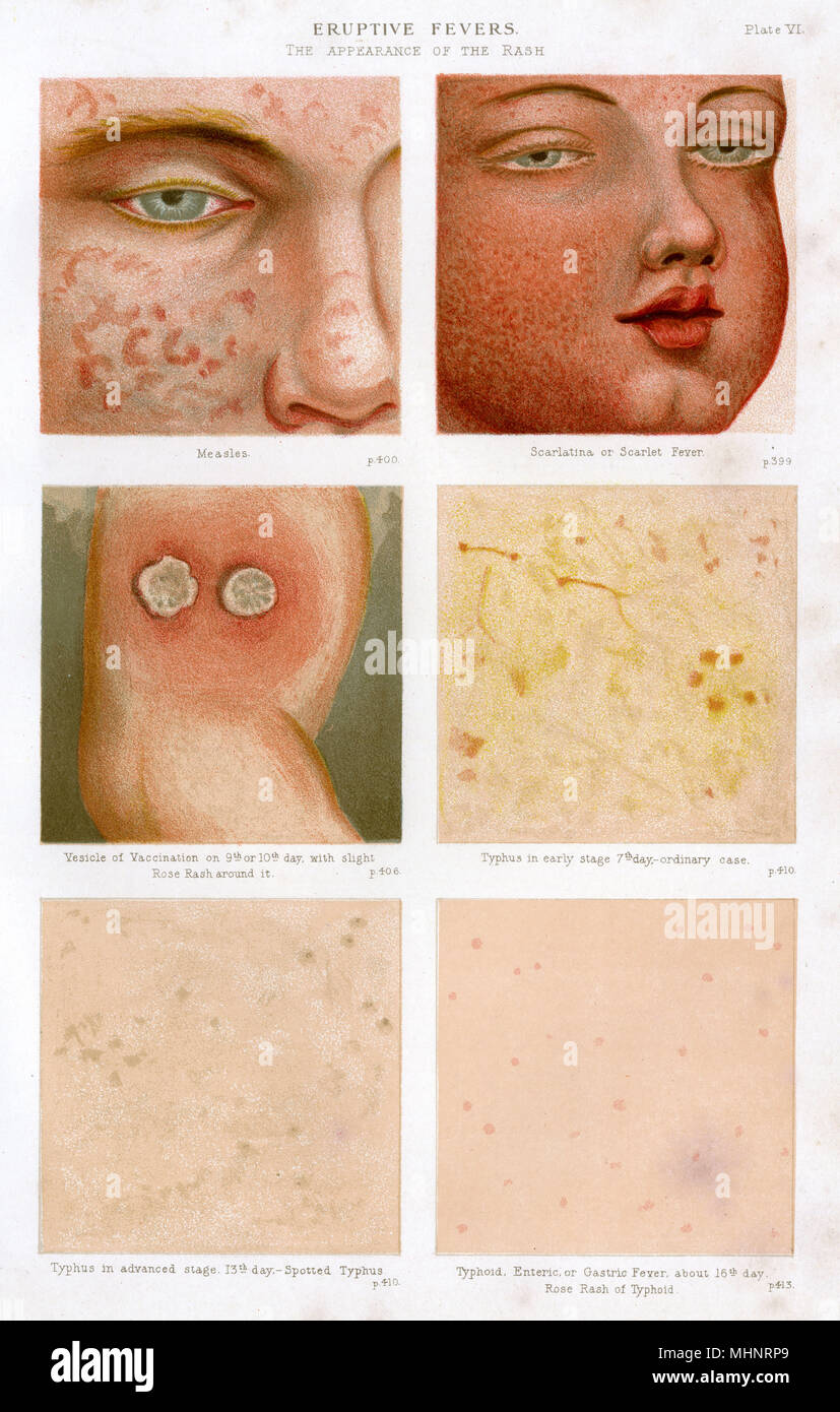 Rose diseases immagini e fotografie stock ad alta risoluzione - Alamy