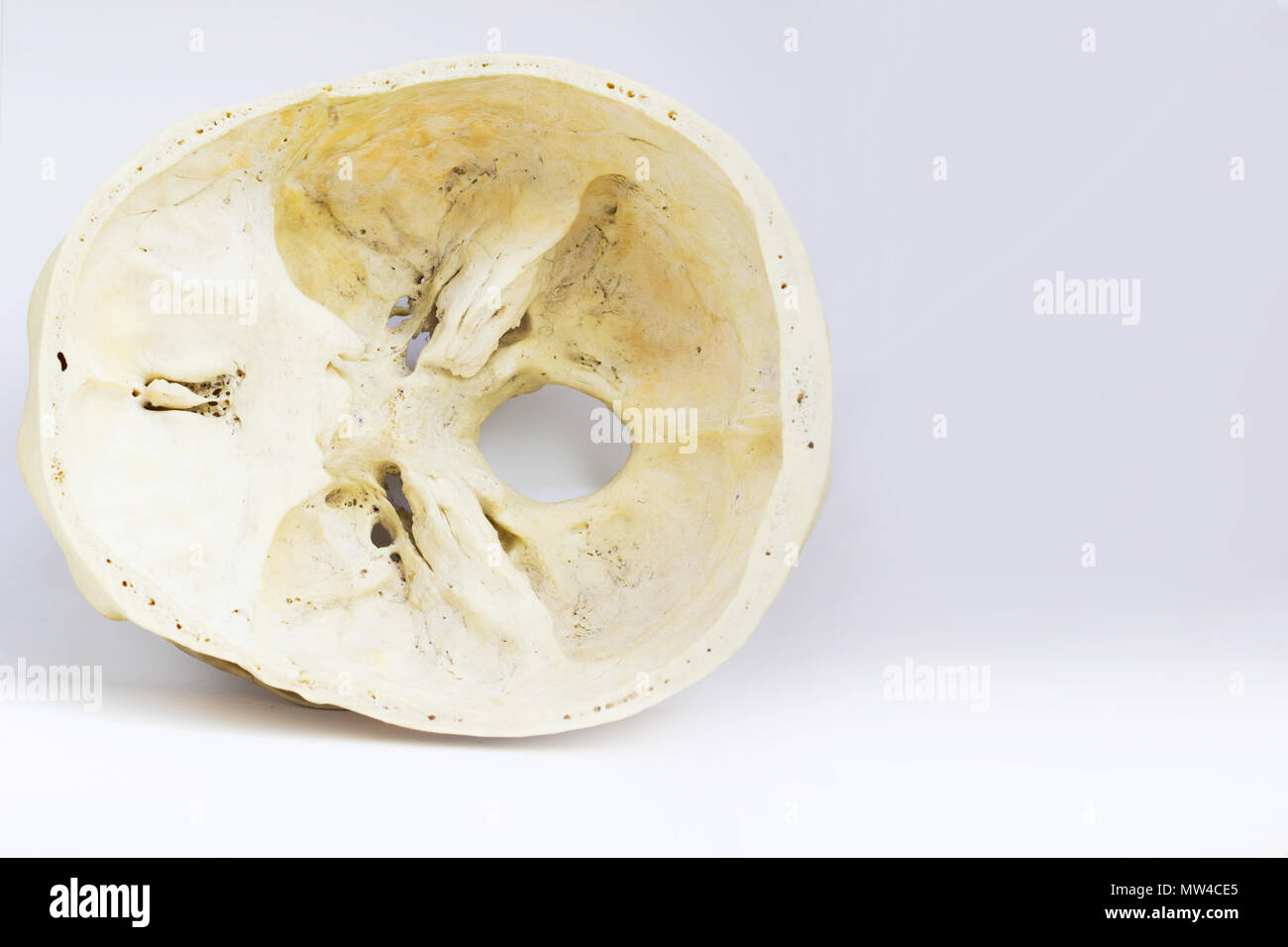 Osso sfenoidale immagini e fotografie stock ad alta risoluzione - Alamy