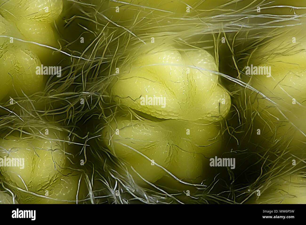 Antere microscope immagini e fotografie stock ad alta risoluzione - Alamy