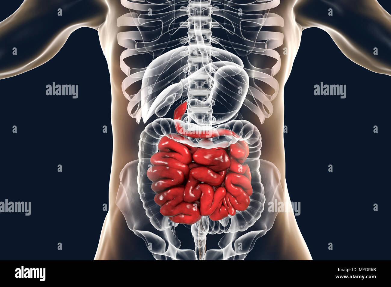 Piccolo intestino immagini e fotografie stock ad alta risoluzione - Alamy