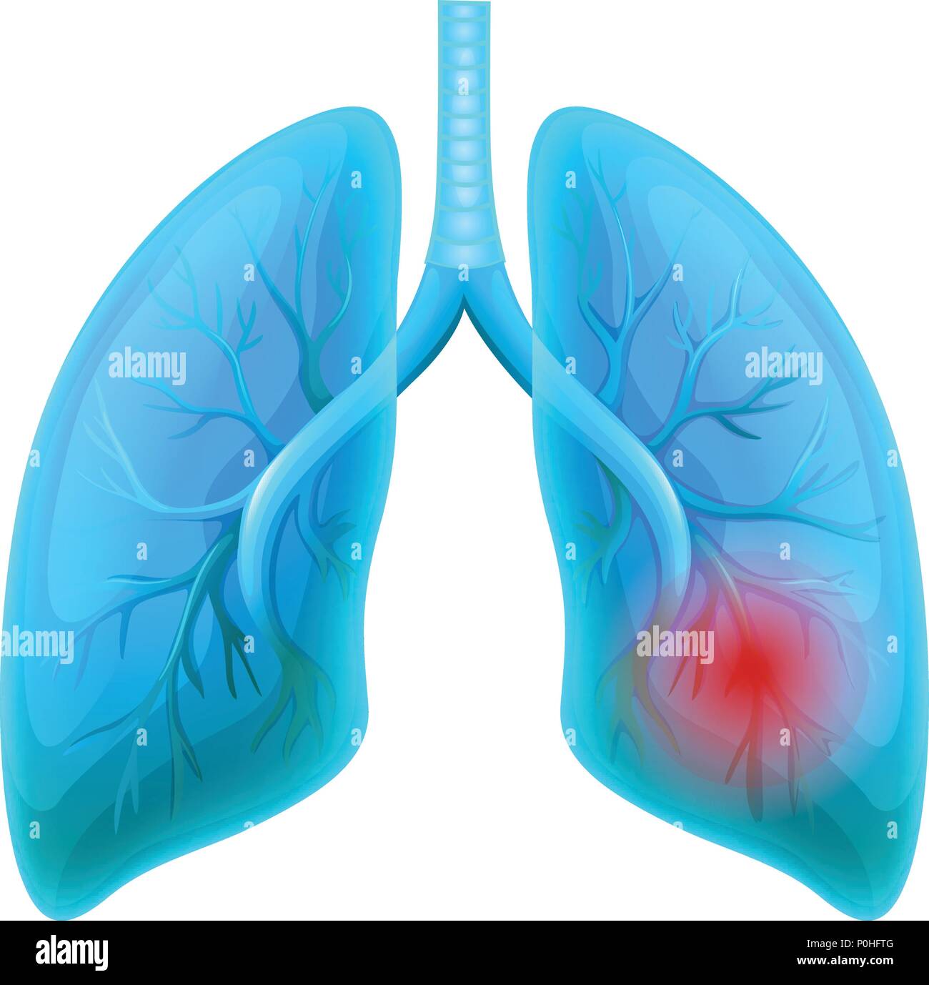 Monitor polmonare Immagini Vettoriali Stock - Alamy