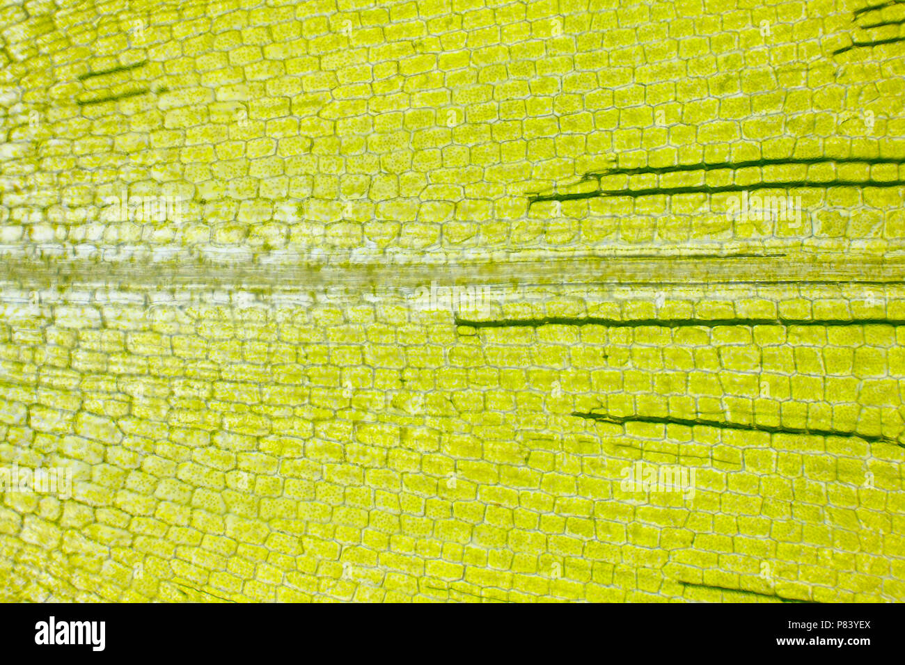 Microscopio Delle Cellule Vegetali Elodea Gli Infinitamente