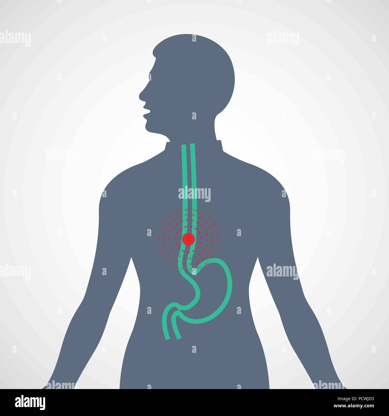Esofago e apparato digerente immagini e fotografie stock ad alta ...
