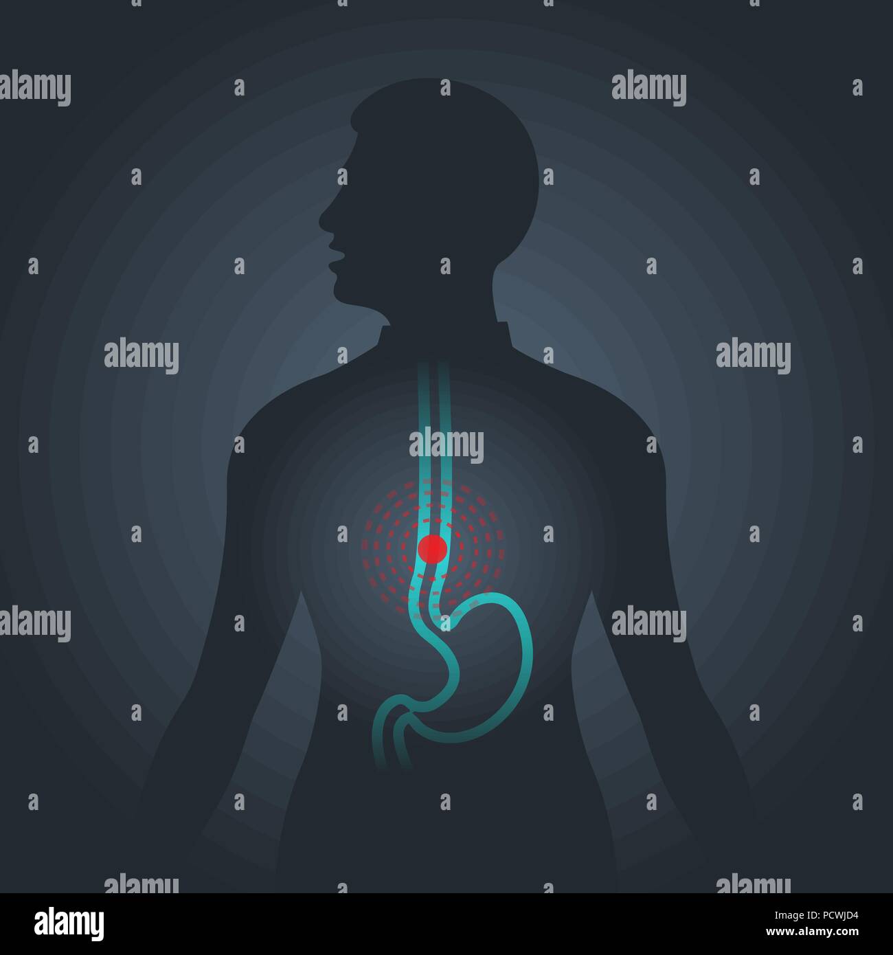 Esofago e apparato digerente immagini e fotografie stock ad alta ...