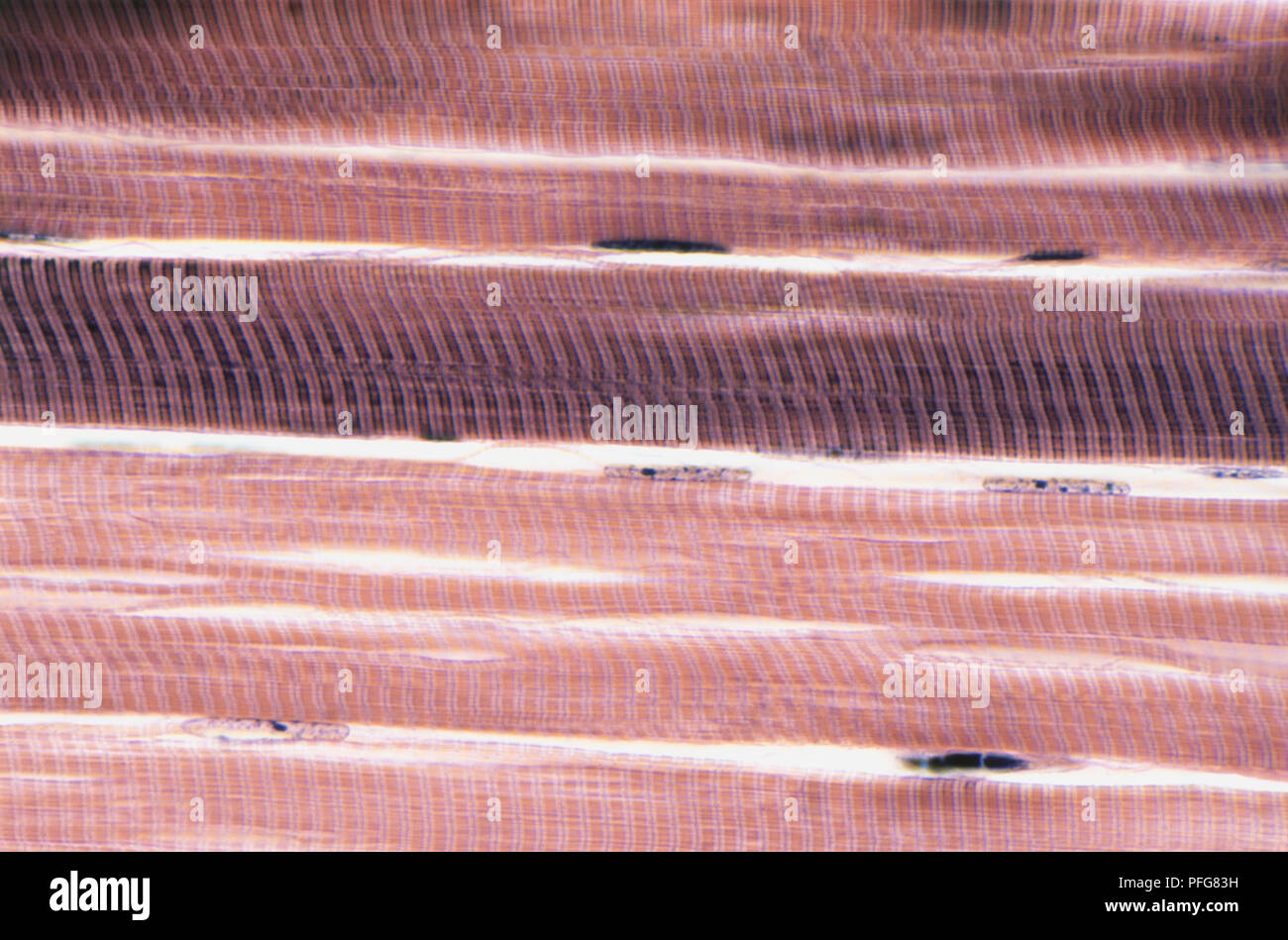 Cellula muscolare scheletrica umana immagini e fotografie stock ad alta ...