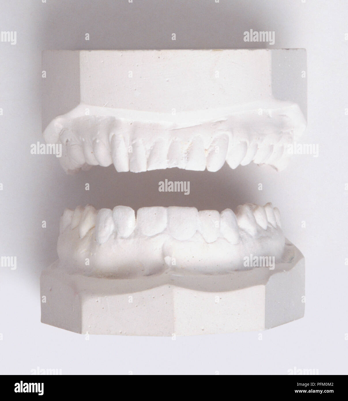 Uneven teeth immagini e fotografie stock ad alta risoluzione - Alamy