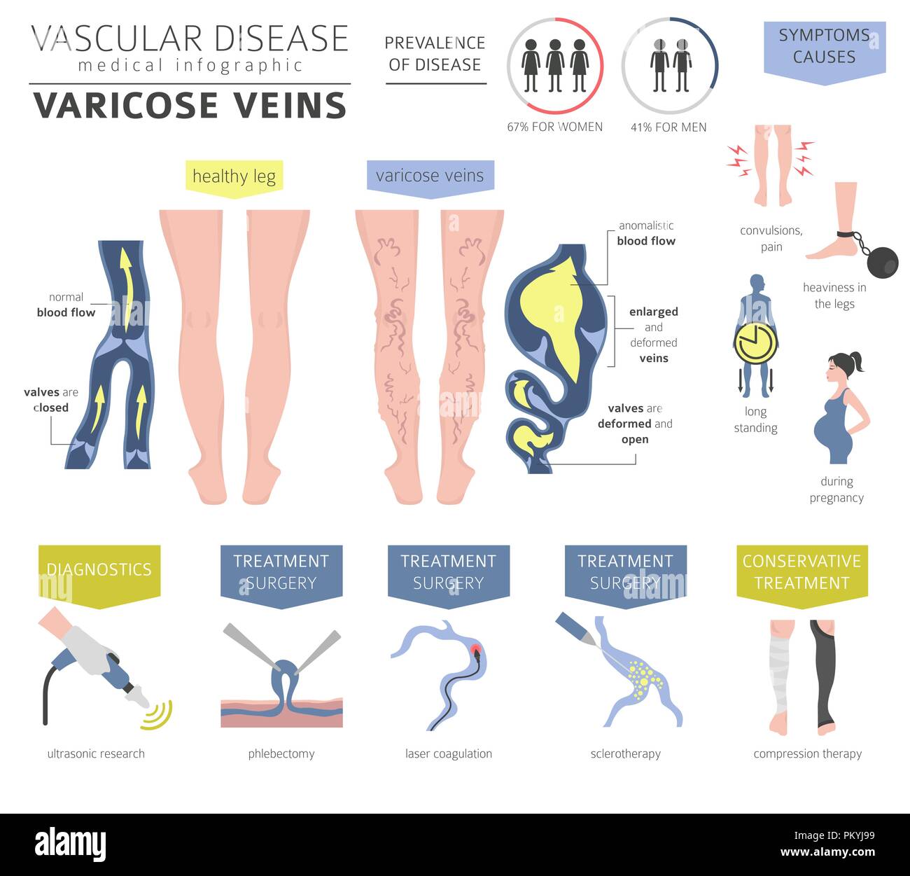 Circolo venoso gambe Immagini Vettoriali Stock - Alamy