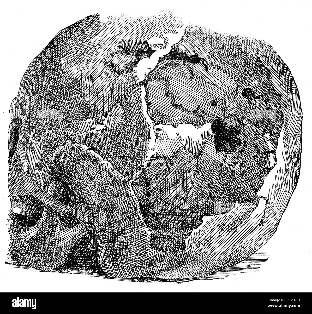 Syphilis historical immagini e fotografie stock ad alta risoluzione - Alamy