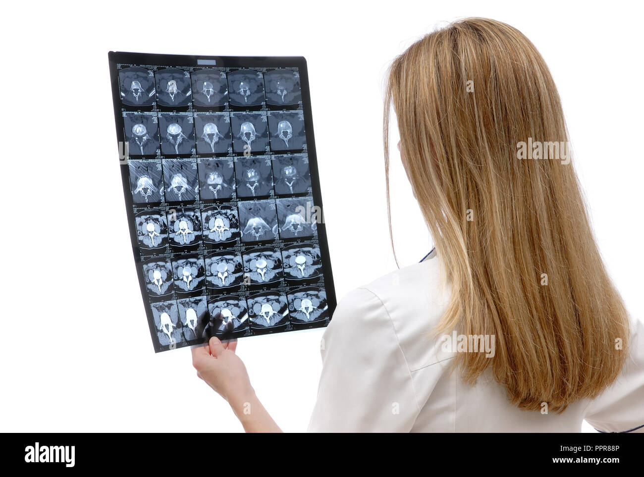 Radiografia medica immagini e fotografie stock ad alta risoluzione - Alamy
