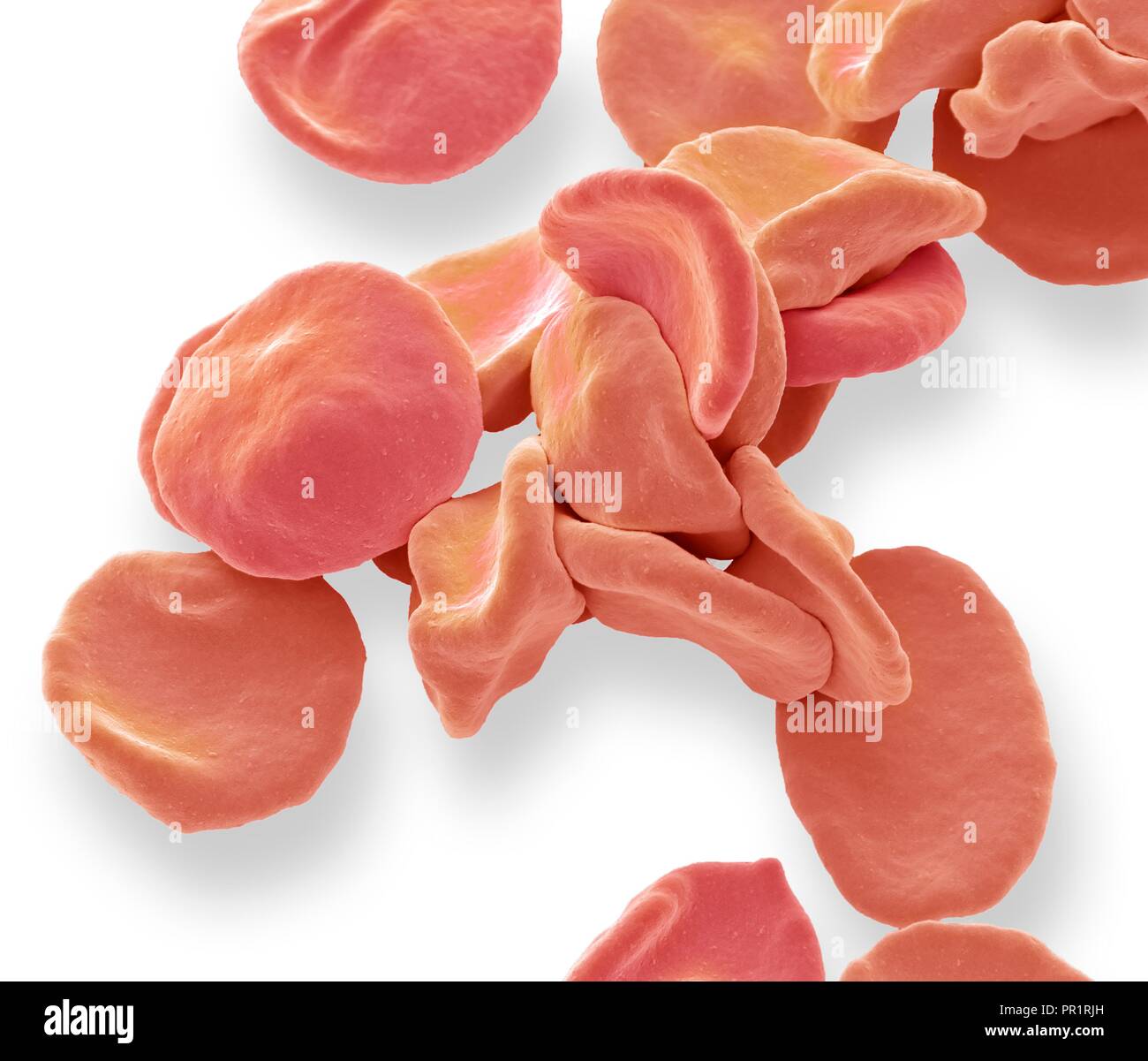 Red blood cell microscope immagini e fotografie stock ad alta ...