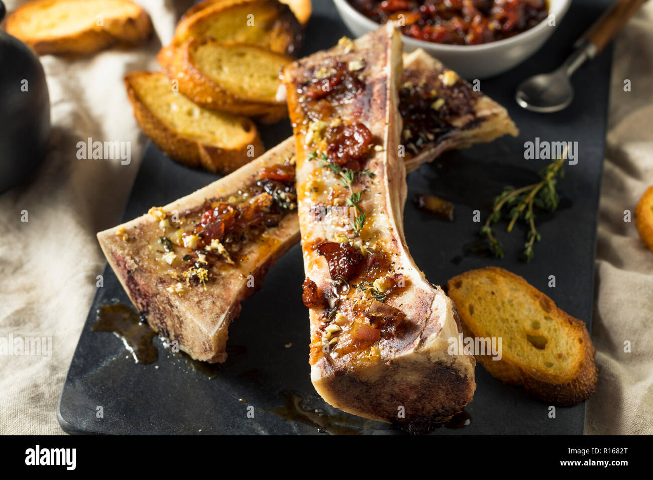 Midollo osseo immagini e fotografie stock ad alta risoluzione - Alamy