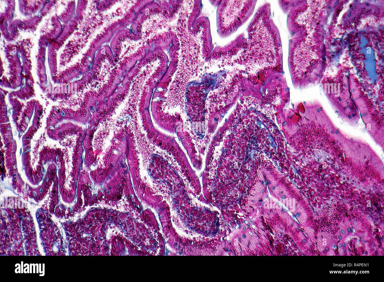 Duodeno microscopica immagini e fotografie stock ad alta risoluzione ...