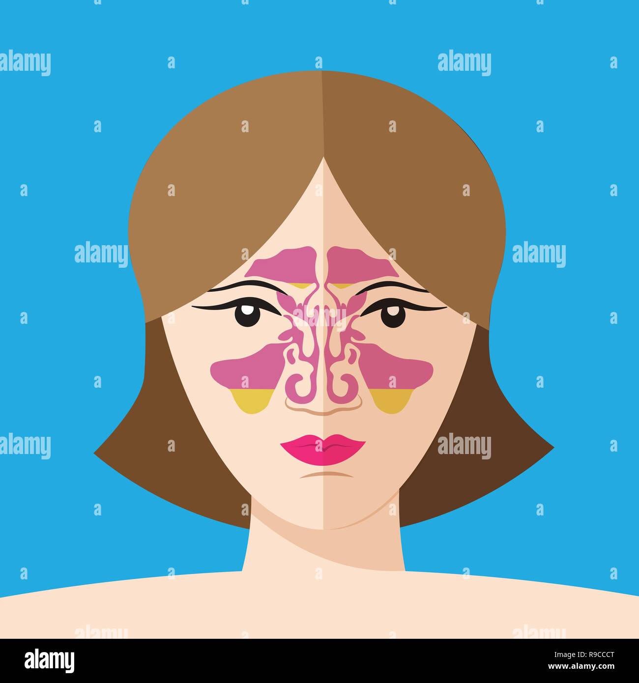 Sinusite malattia, vettore illustrazione del naso, seni, anatomia umana ...