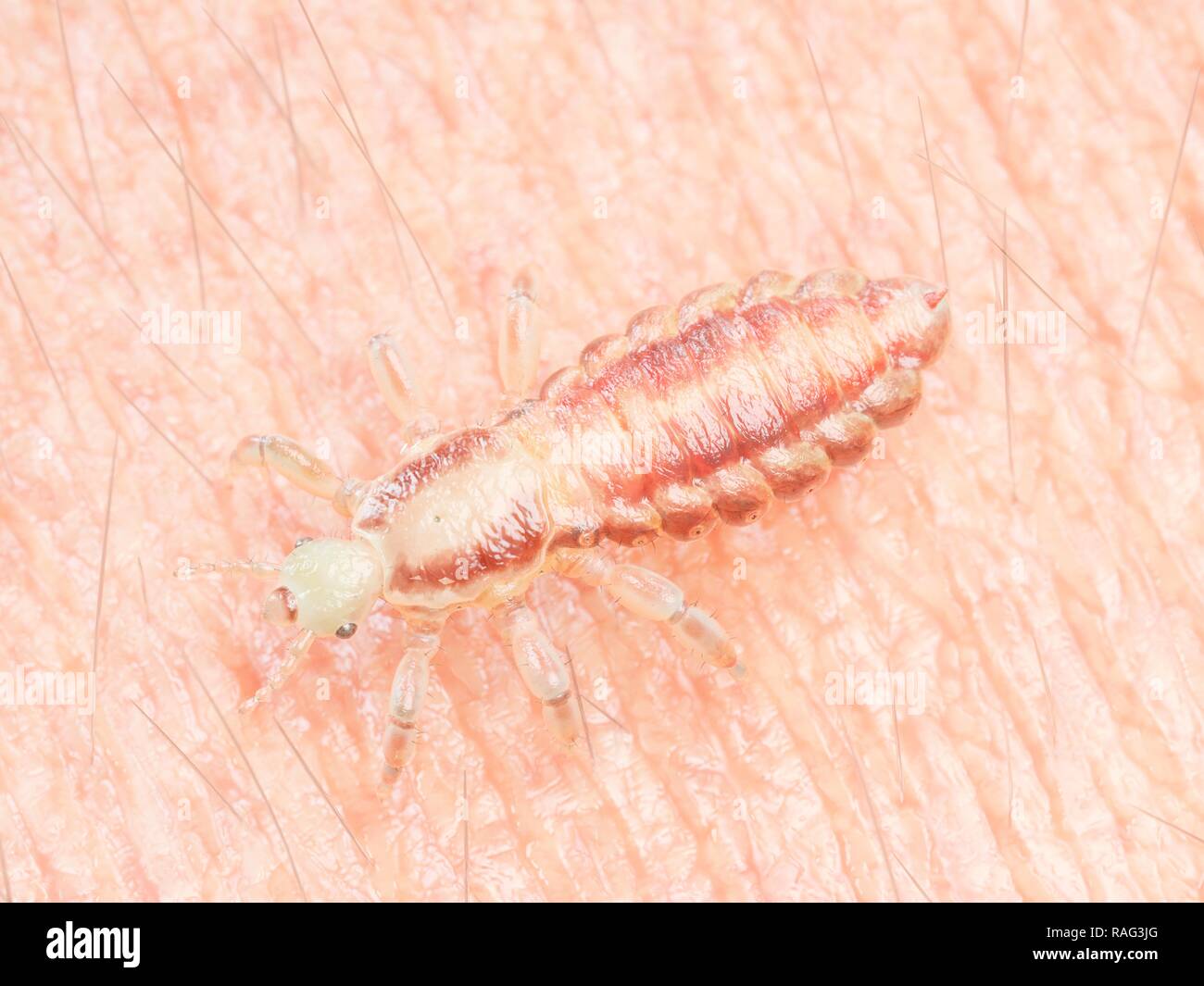 Morso di pidocchi immagini e fotografie stock ad alta risoluzione - Alamy