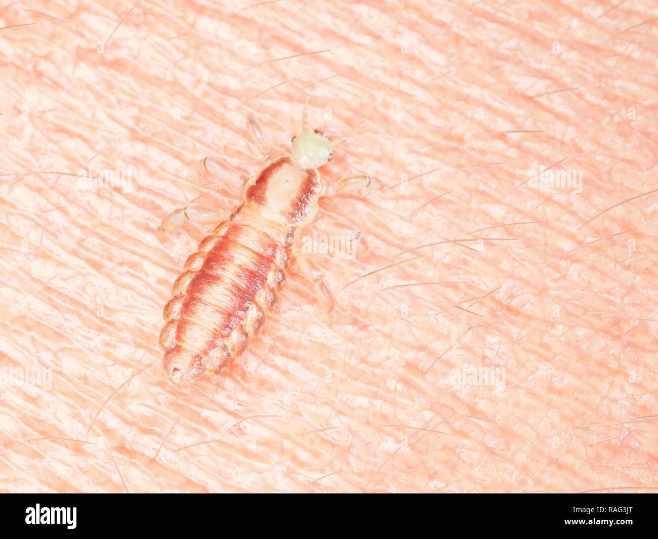 Morso di pidocchi immagini e fotografie stock ad alta risoluzione - Alamy