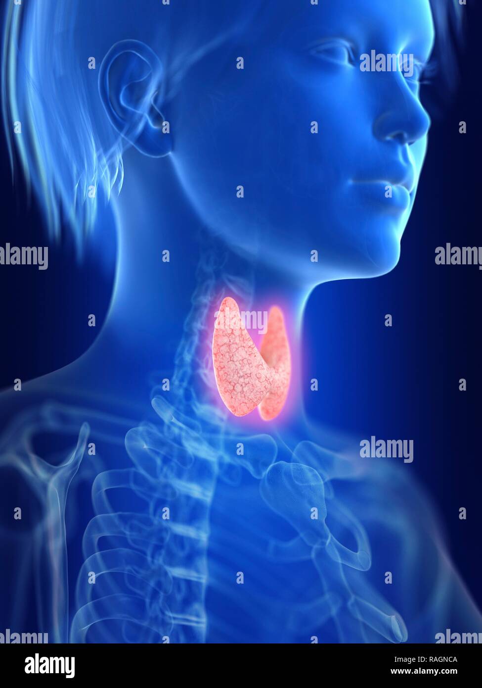 Tiroide infiammata immagini e fotografie stock ad alta risoluzione - Alamy