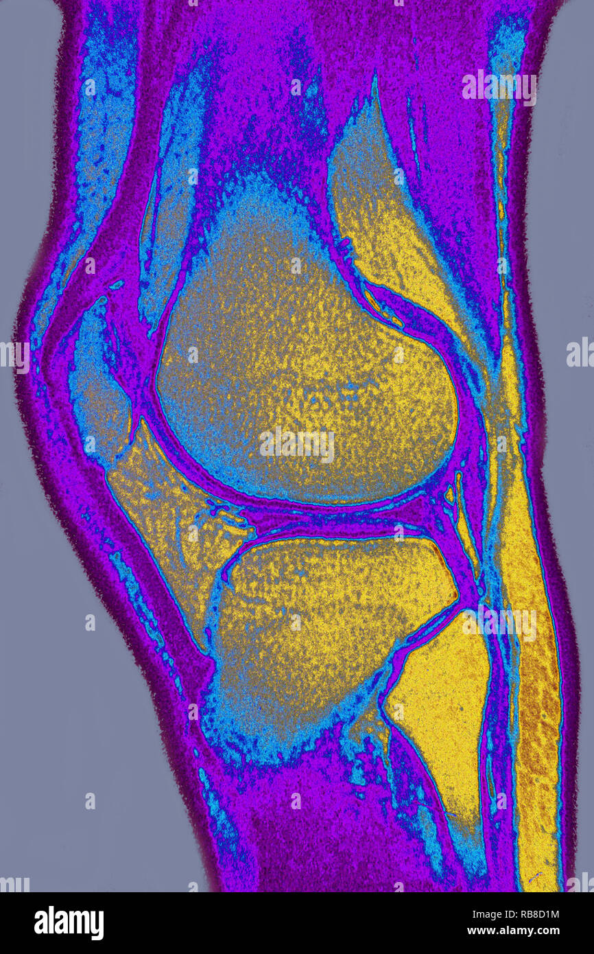 Piani anatomici Immagini e Fotos Stock - Alamy