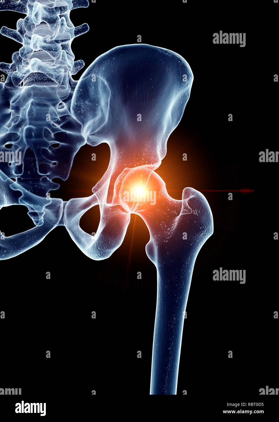 Human body anatomy inflammation x ray immagini e fotografie stock ad ...