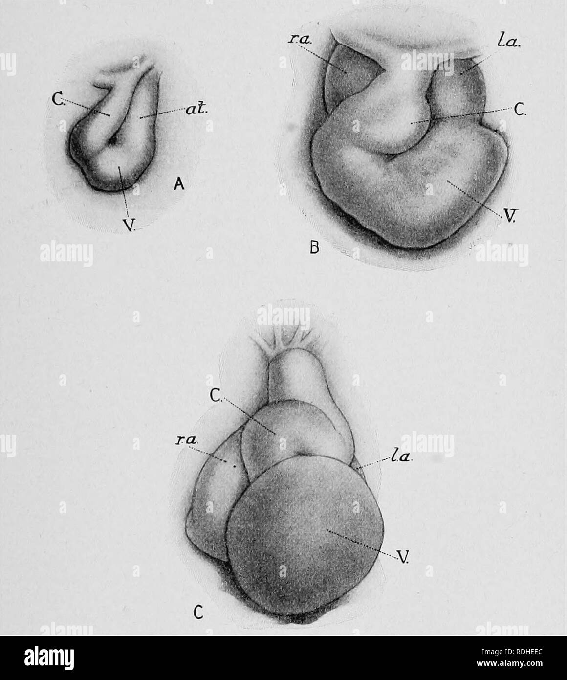 Atrio ventricolare destro immagini e fotografie stock ad alta ...