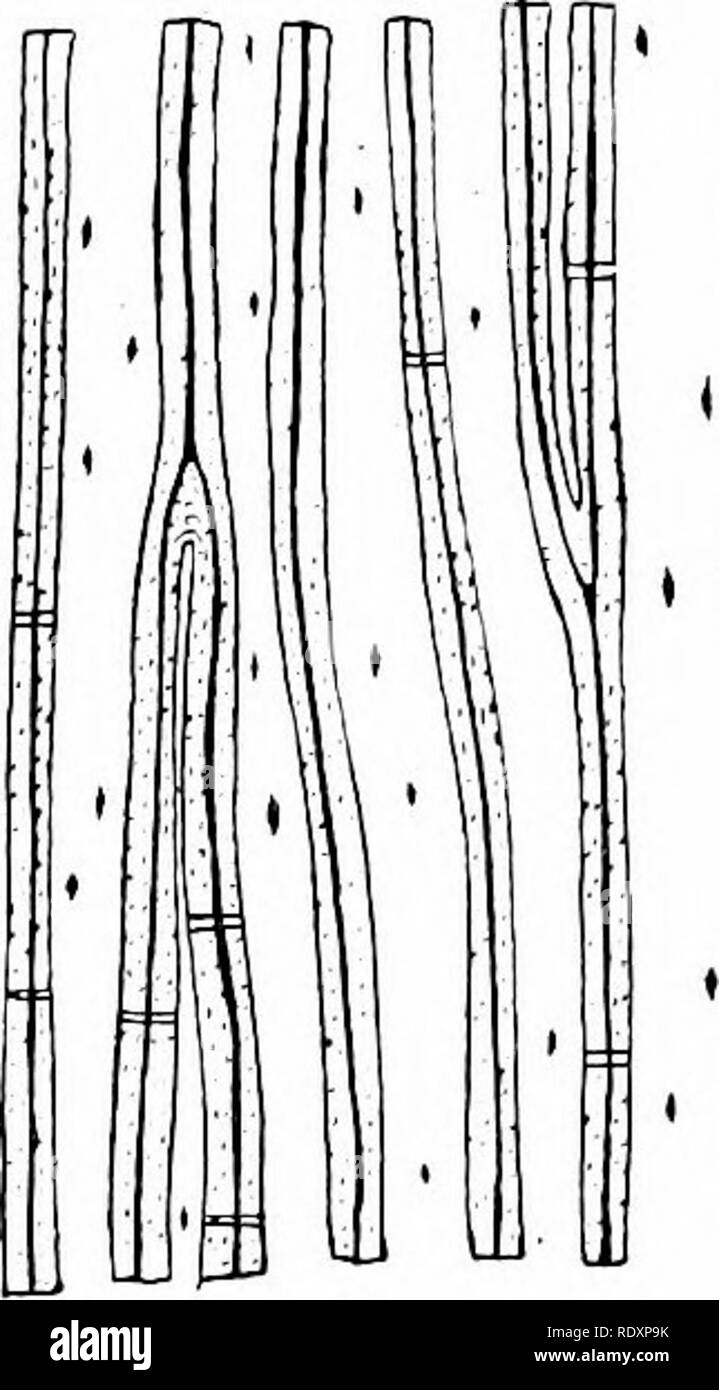 Fibre di sclerenchima immagini e fotografie stock ad alta risoluzione ...