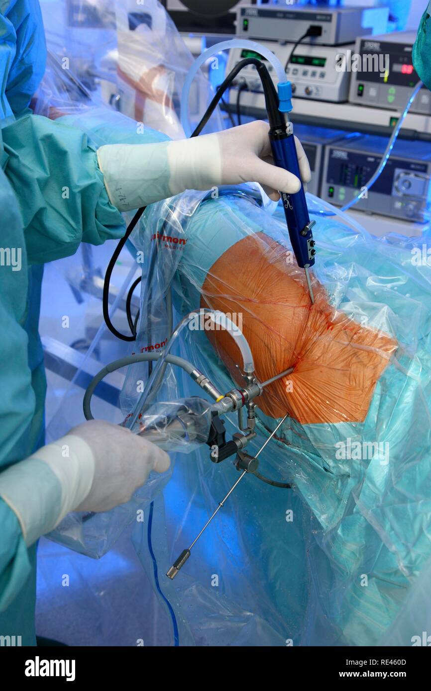 Artroscopia dell'anca immagini e fotografie stock ad alta risoluzione ...