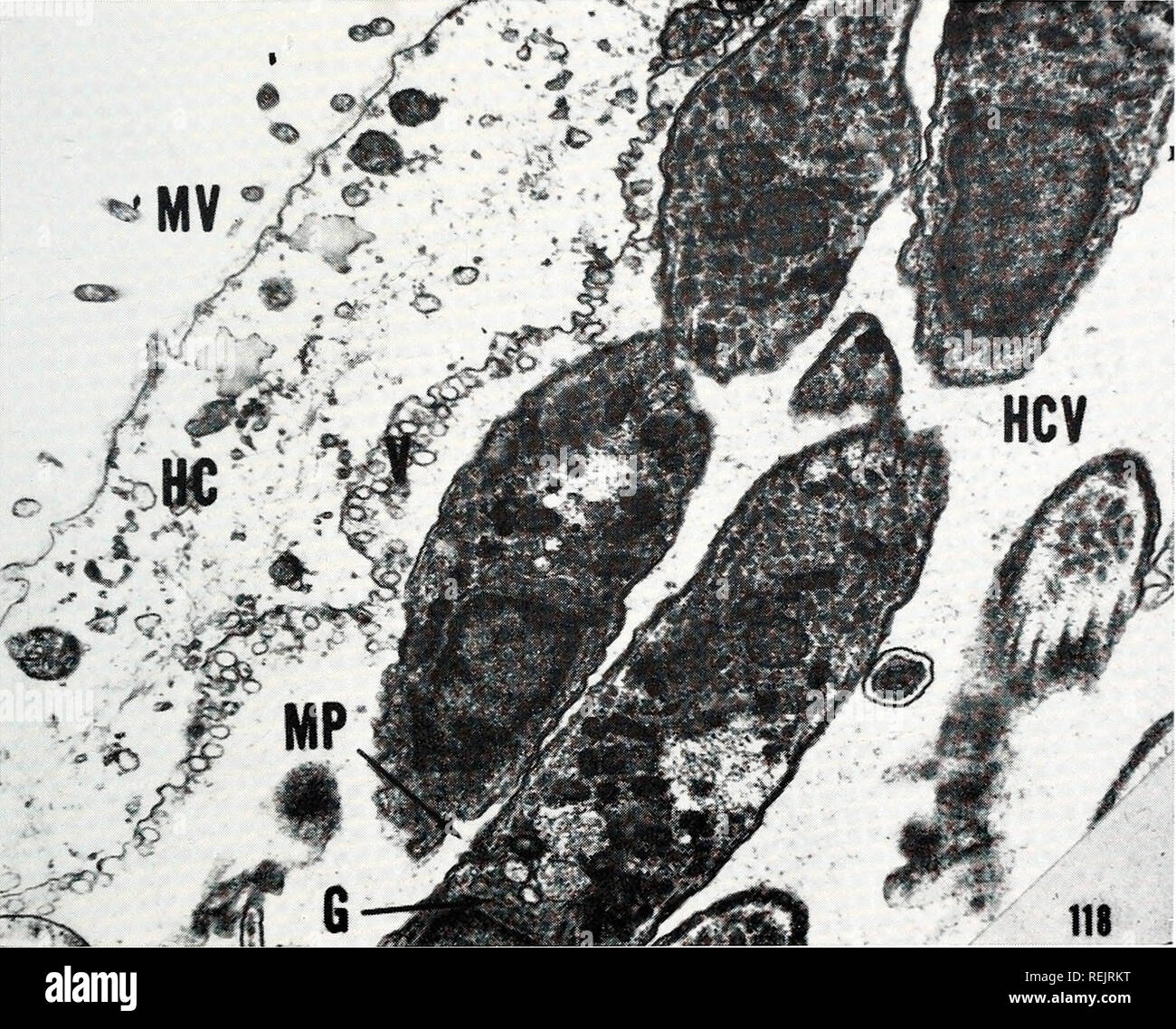 Vescicola lipidica immagini e fotografie stock ad alta risoluzione - Alamy