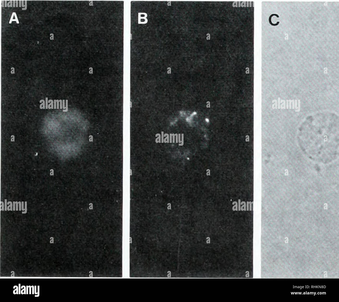 Anticorpo ig m immagini e fotografie stock ad alta risoluzione - Alamy