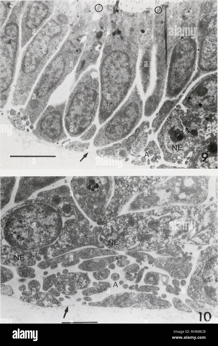 Citoplasma de la neurona immagini e fotografie stock ad alta ...