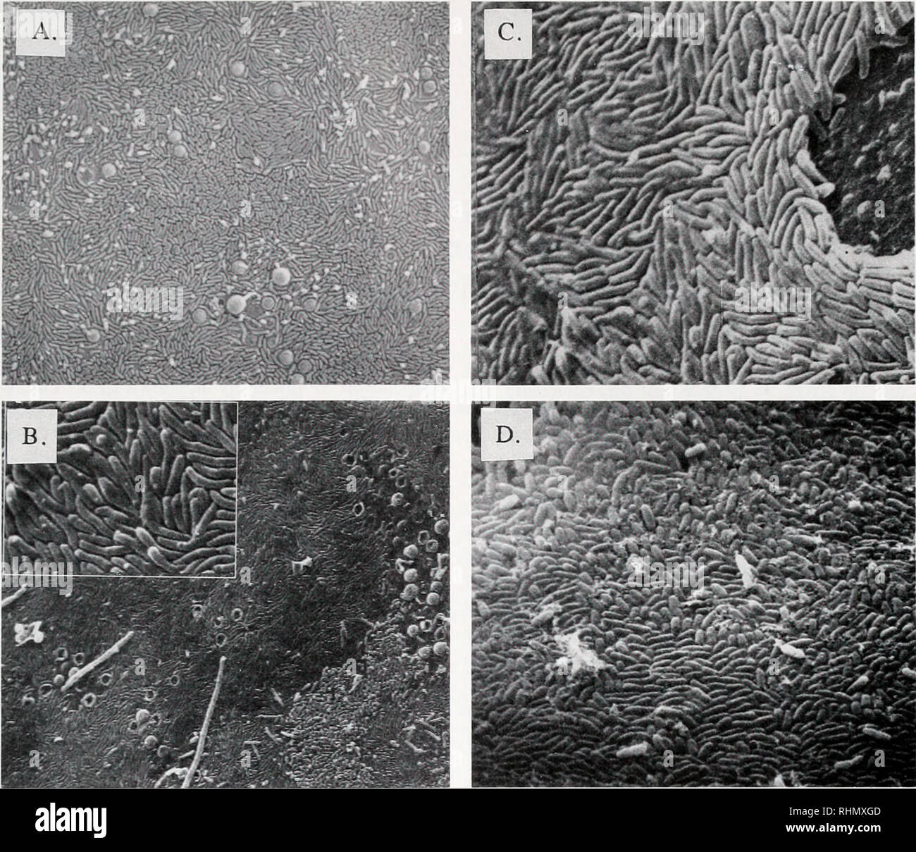 Vari tipi di batteri immagini e fotografie stock ad alta risoluzione ...