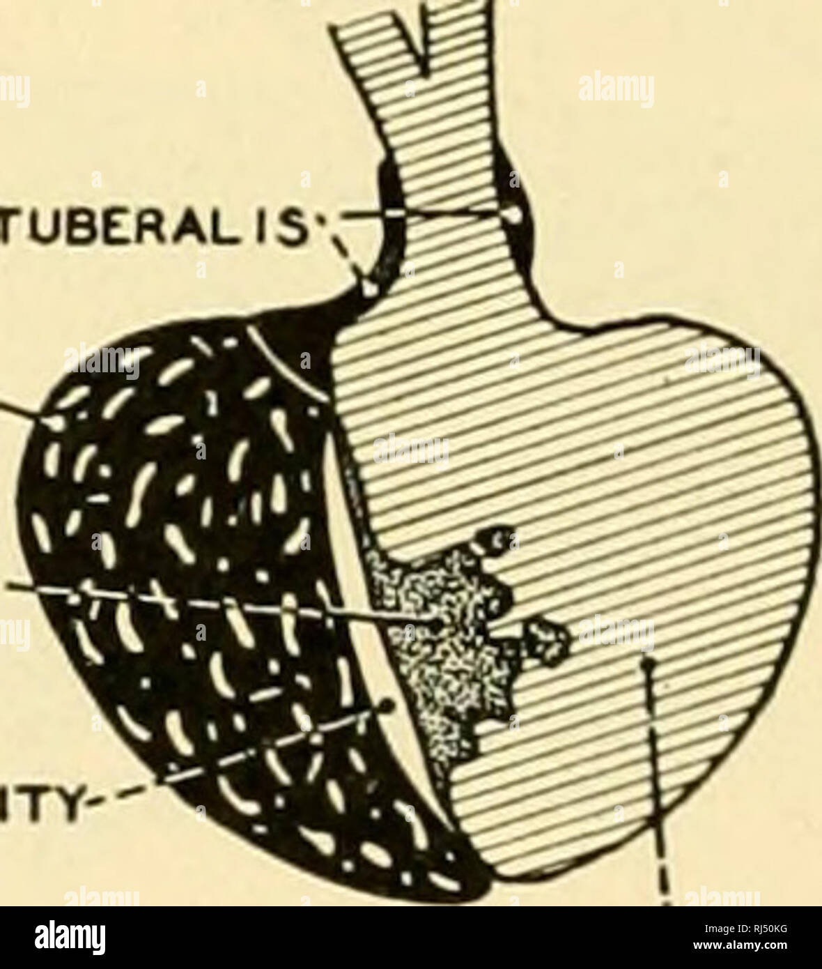 Pars tuberalis immagini e fotografie stock ad alta risoluzione - Alamy