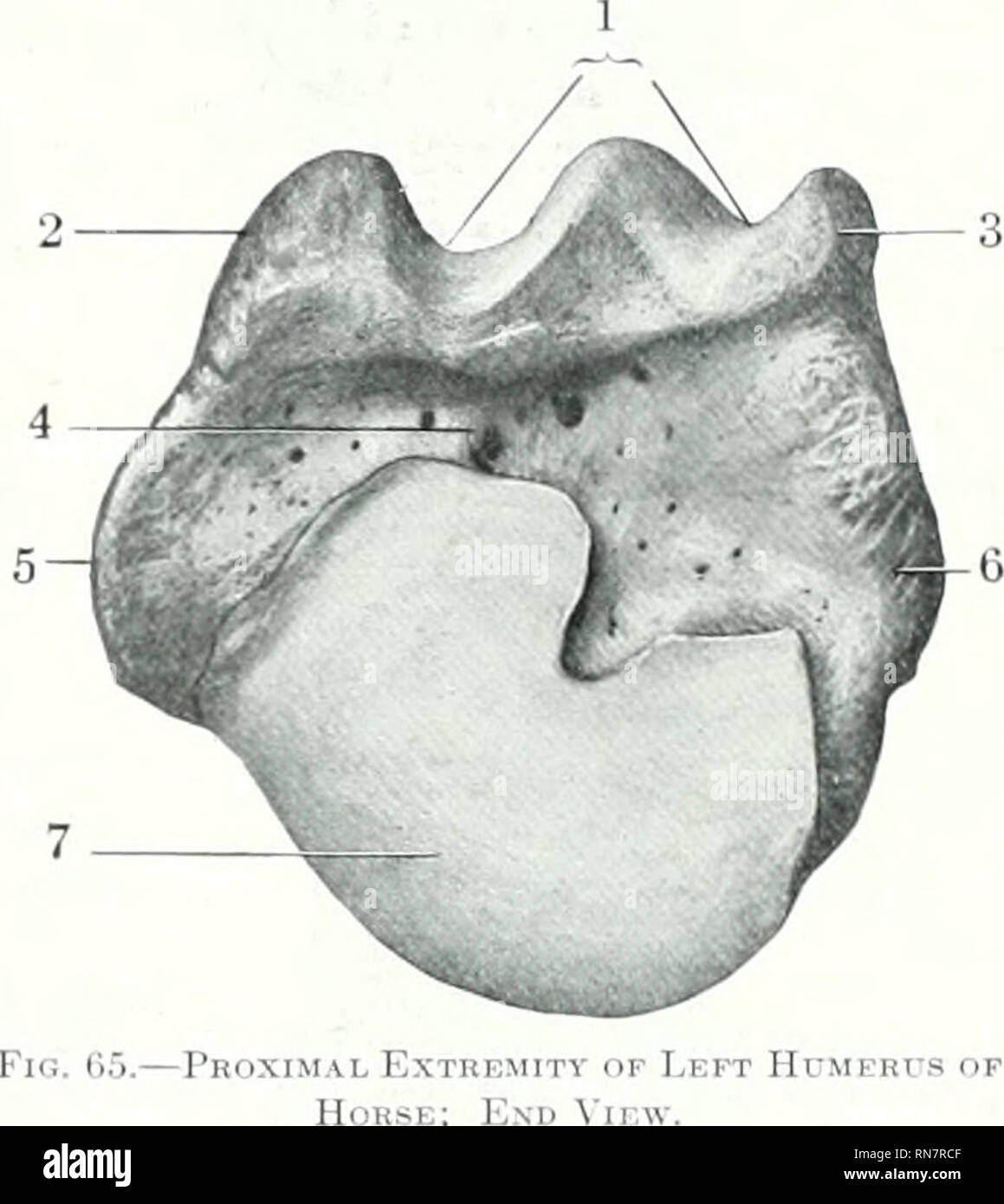 Fossa coronoide immagini e fotografie stock ad alta risoluzione - Alamy