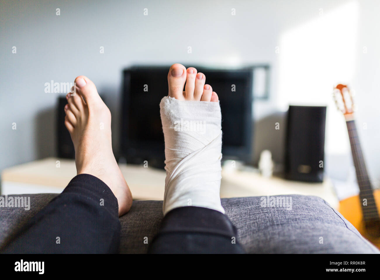 Gamba ingessata uomo immagini e fotografie stock ad alta risoluzione ...