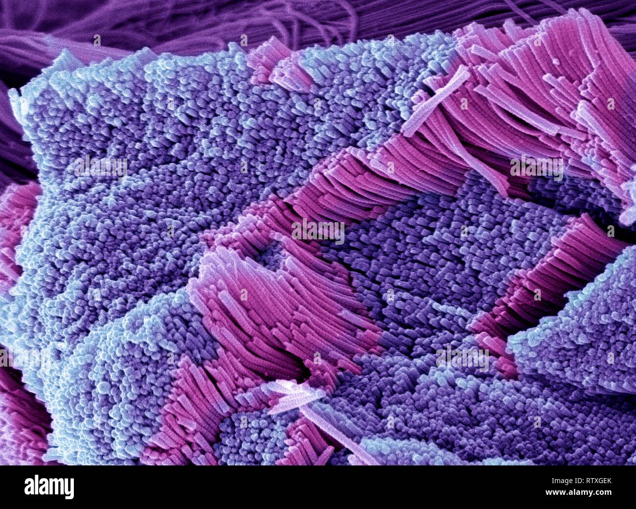 Fibre di collagene immagini e fotografie stock ad alta risoluzione - Alamy