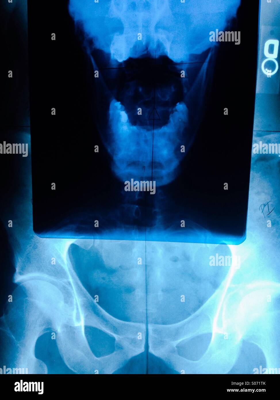 Osso pelvico immagini e fotografie stock ad alta risoluzione - Alamy