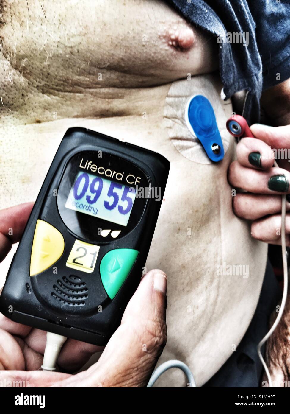 Lifecard cf ecg monitor immagini e fotografie stock ad alta risoluzione ...