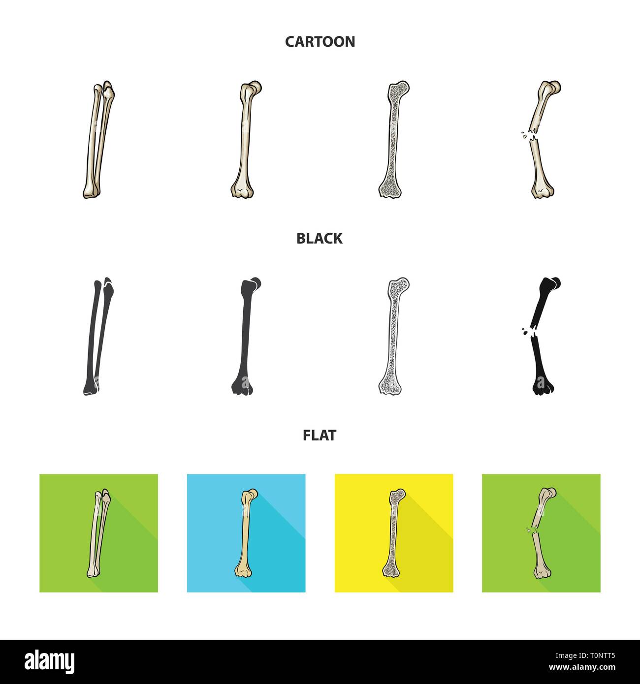 Femore,frattura,rotto,,osseo dolore,gamba,fibula,bias,GINOCCHIO,shin ...