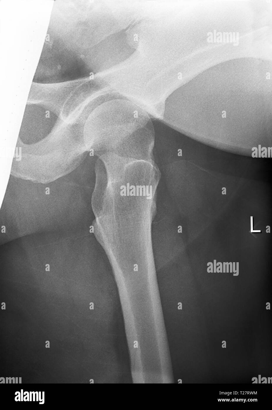 Tuberosità ischiatica immagini e fotografie stock ad alta risoluzione ...