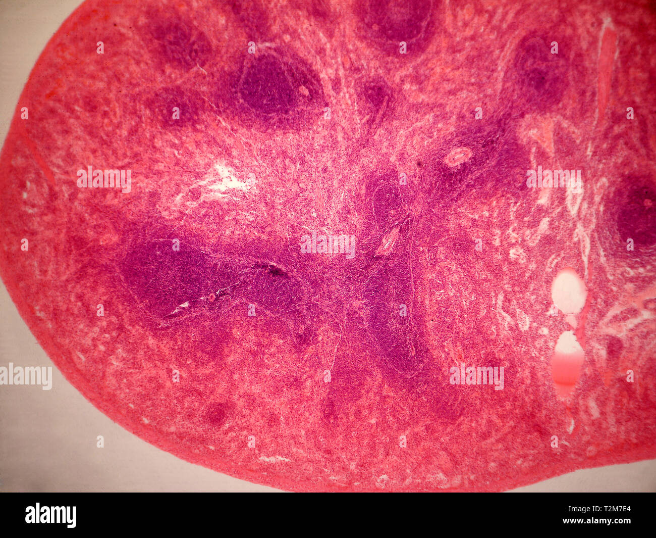 Milza di milza immagini e fotografie stock ad alta risoluzione - Alamy